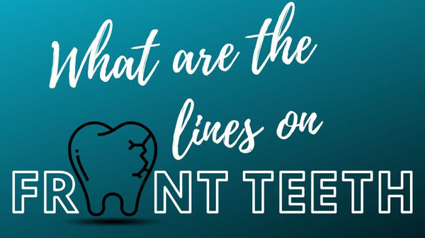 What are the lines on the front of my teeth - GREAT ORAL HEALTH