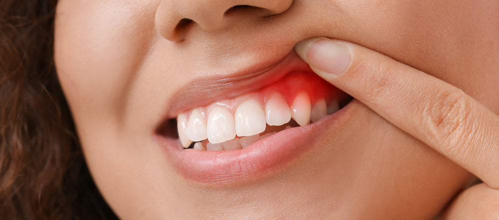 How You Can Detect Beginning Stages Of Gingivitis – GREAT ORAL HEALTH