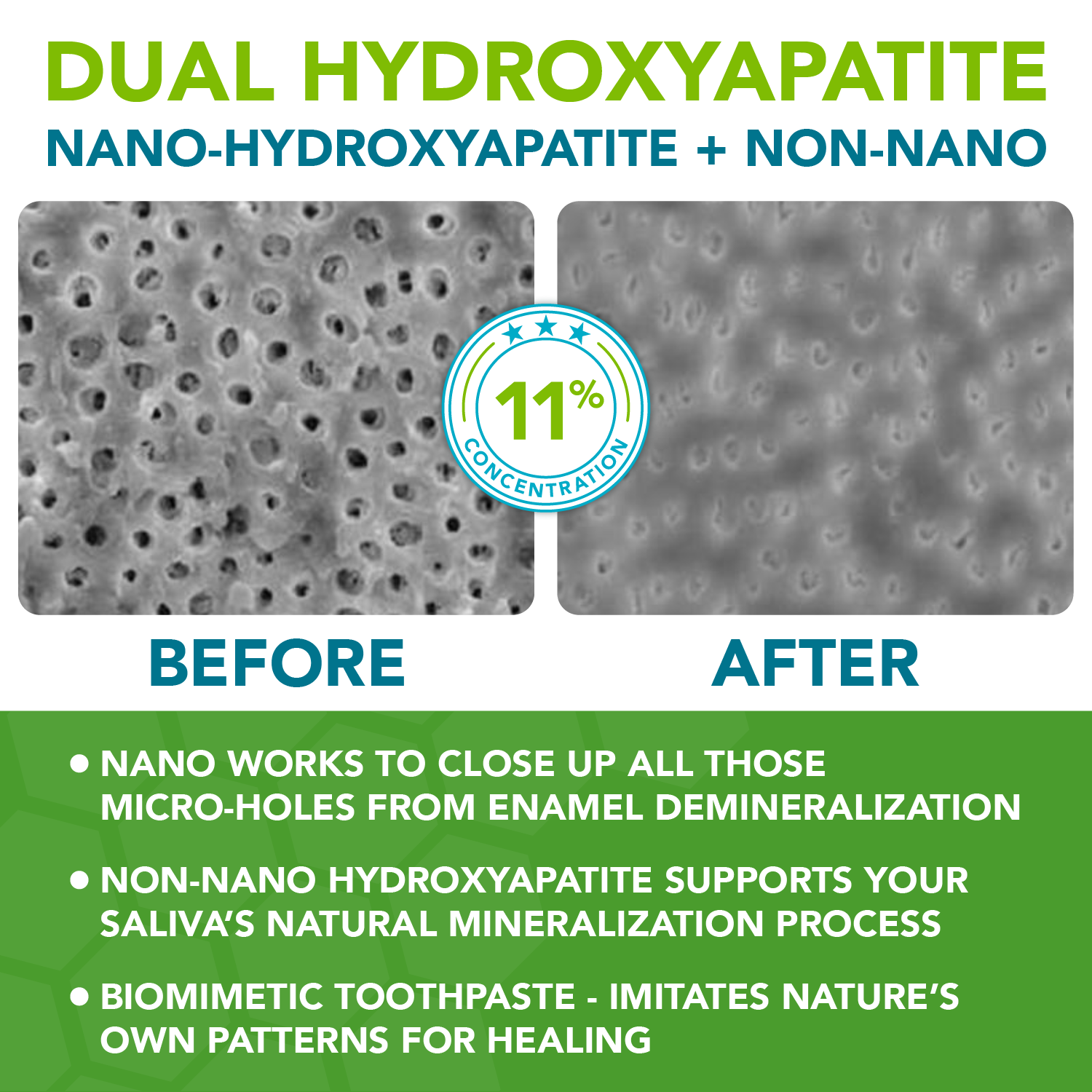 Dentist Formulated Fluoride Free Remineralizing Toothpaste with Nano H ...